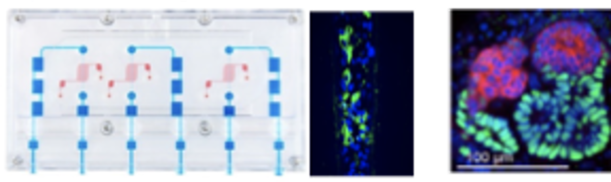 Extended Culture of Kidney MPS and Organoids to Model Acute and Chronic ...