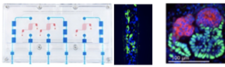 Extended Culture of Kidney MPS and Organoids to Model Acute and Chronic ...