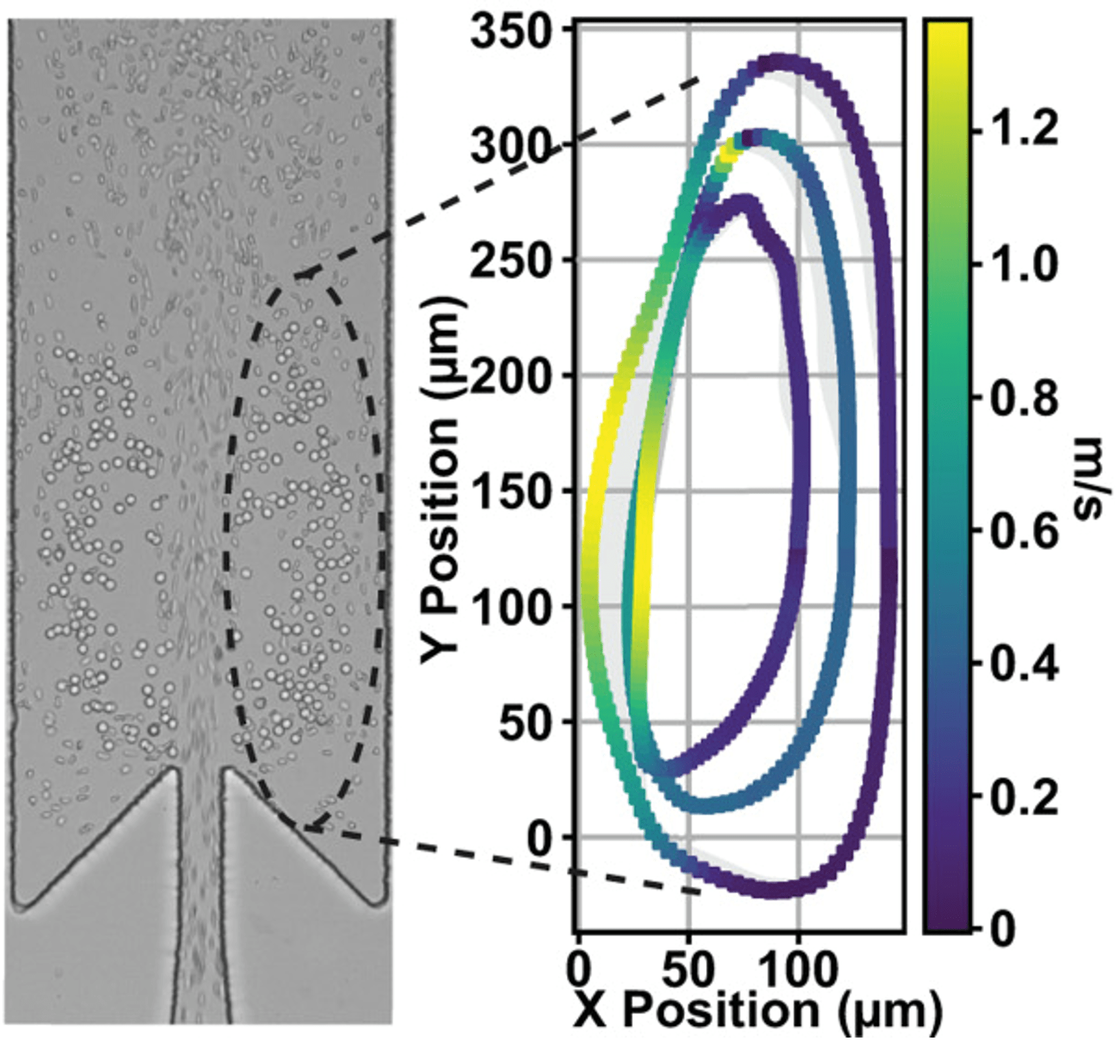 How do Dangerous Blood Clots Form in Space? New Insights from a Valve ...