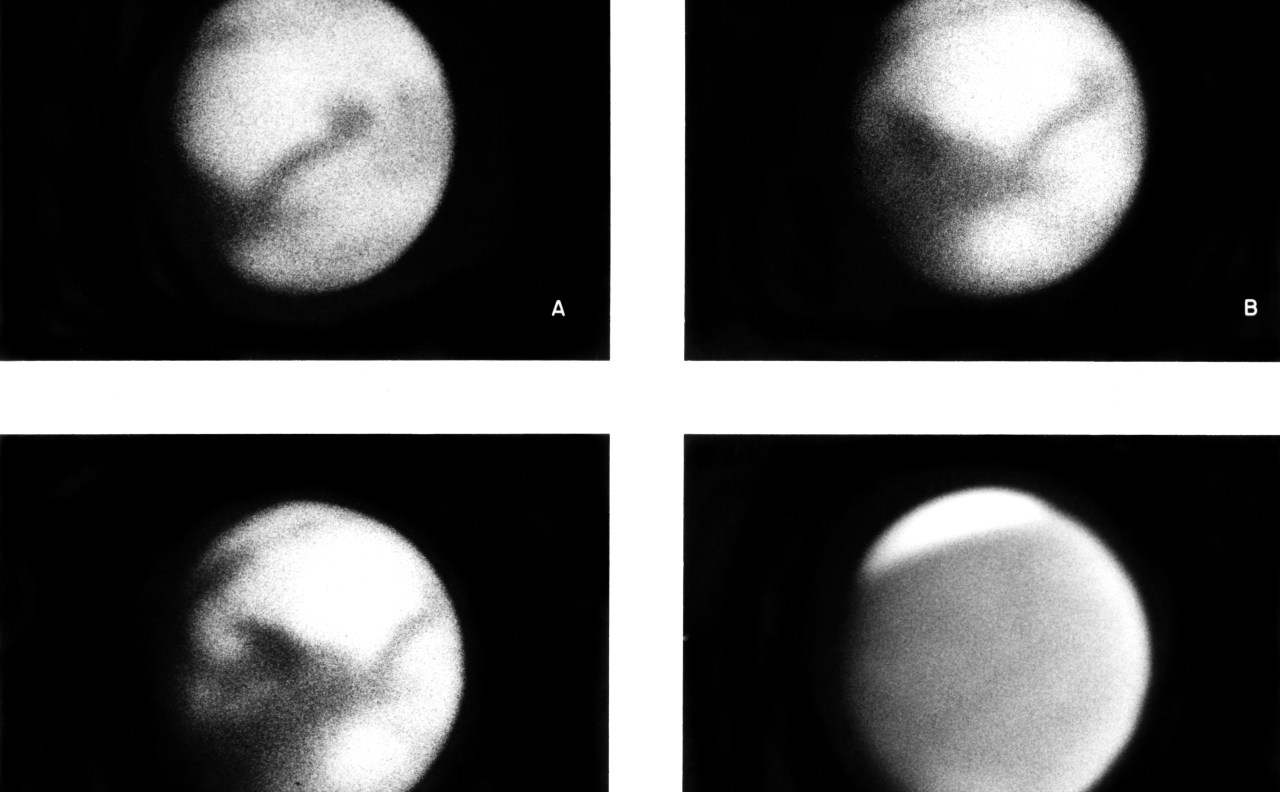 Planet Mars, As Seen by the 100 Inch Telescope at Mount Wilson ...